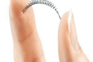 Essure Implant Claims – Medical Law