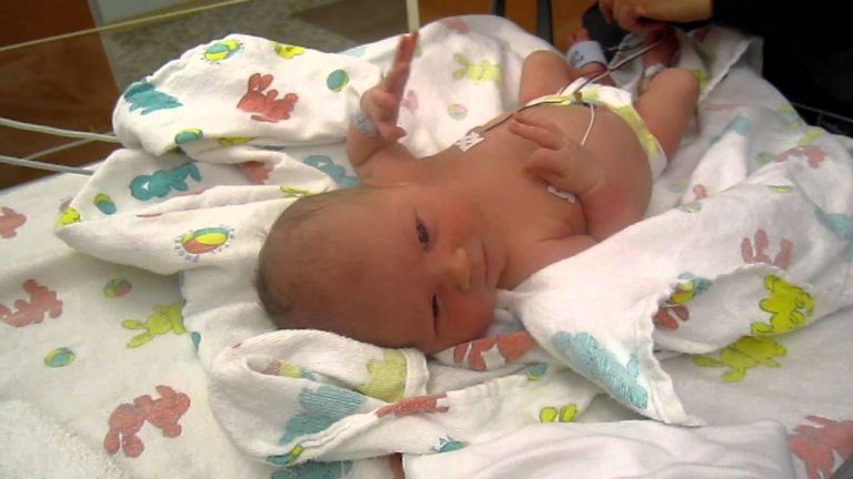 Neonatal Seizures (Infant Seizures) and Birth Injury – Medical Law